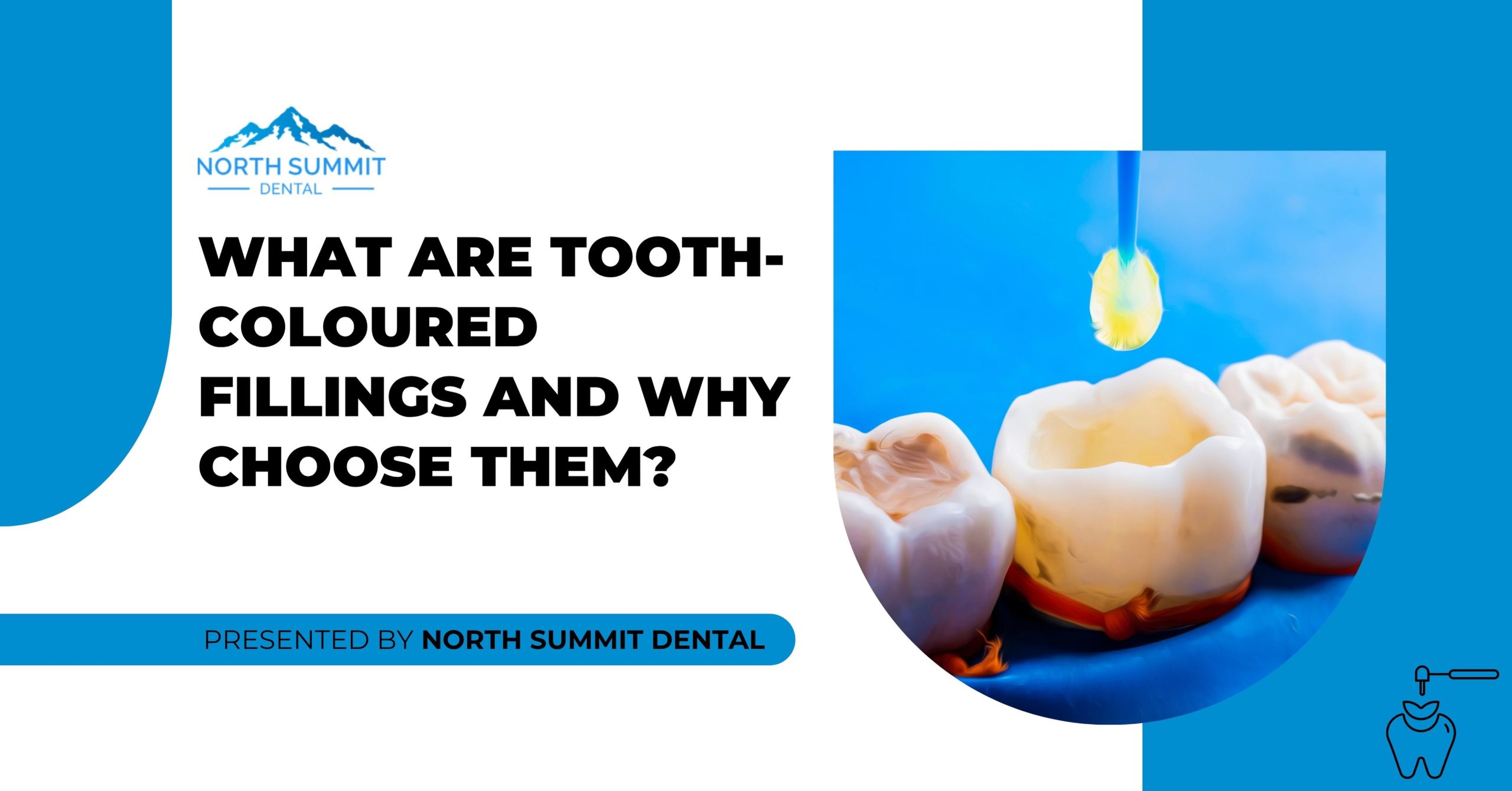 What Are Tooth-Coloured Fillings and Why Choose Them?